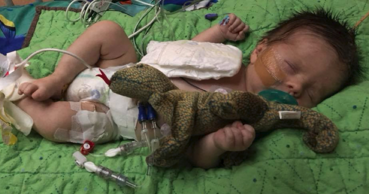Baby Diagnosed with Terminal Brain Condition in Womb, Miracle Happens ...