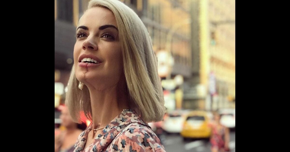 Singer Loses Half Her Tongue to Cancer But that Doesn't Stop Her from ...